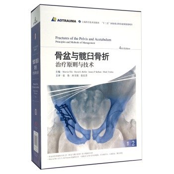 Pelvic and acetabular fracture treatment principles and techniques (set ...