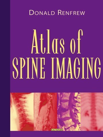 Atlas of Spine Imaging: 9780721690711: Medicine & Health Science Books ...