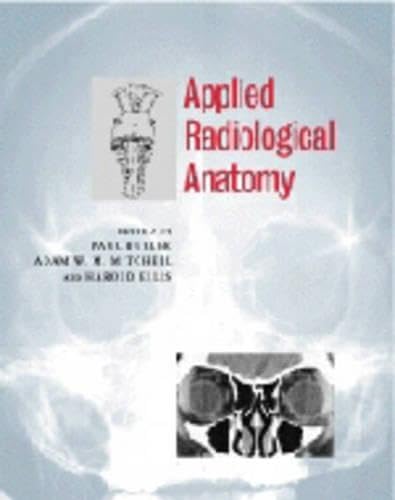 Applied Radiological Anatomy: 9780521481106: Medicine & Health Science ...