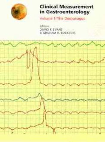 Evans, David, Buckton, Graham: 9780865426627: Amazon.com: Books