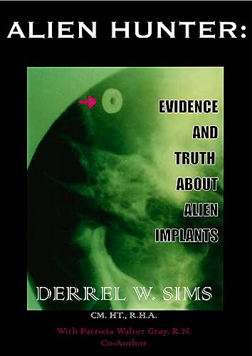 Alien Implants: Evidence & Truth about Alien Implants eBook : Sims ...
