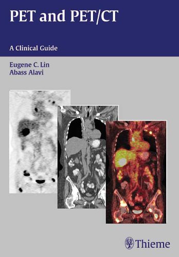 PET and PET/CT: A Clinical Guide: 9781588904003: Medicine & Health ...