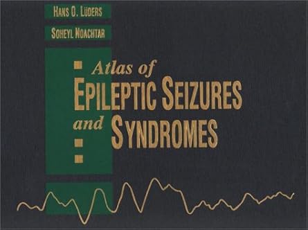 Atlas of Epileptic Seizures and Syndromes, Text & CD-ROM: 9780721669465 ...