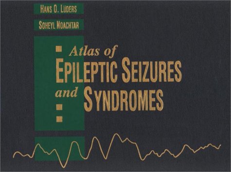Atlas of Epileptic Seizures and Syndromes, Text & CD-ROM: 9780721669465 ...