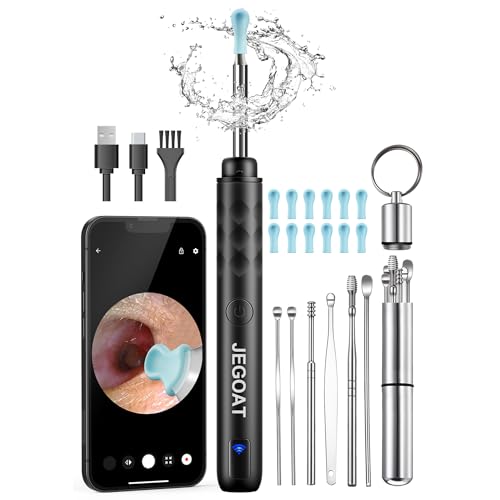 Ear Wax Removal Tool Camera, Ear Cleaner with Camera, 1296P HD Ear ...