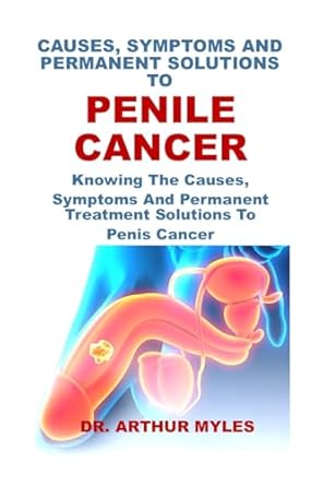 Amazon.com: CAUSES, SYMPTOMS AND PERMANENT SOLUTIONS TO PENILE CANCER ...