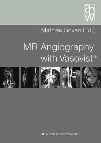 Buy MR Angiography with Vasovist Book Online at Low Prices in India ...