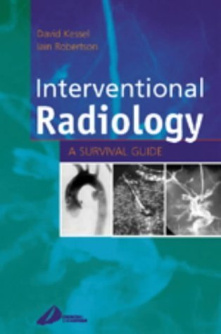 Interventional Radiology: A Survival Guide: 9780443062896: Medicine ...