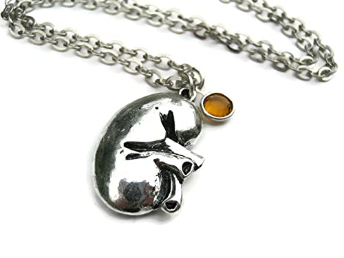 Amazon.com: Personalized Kidney Necklace, Anatomy Birthstone Necklace ...
