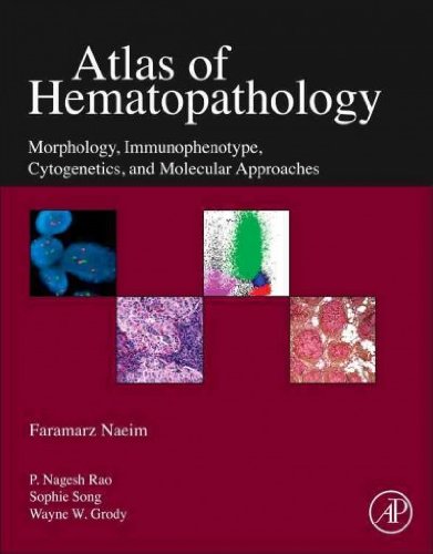 Atlas of Hematopathology: Morphology, Immunophenotype, Cytogenetics ...