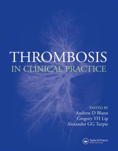Amazon.com: Thrombosis in Clinical Practice eBook : Alexander GG Turpie ...