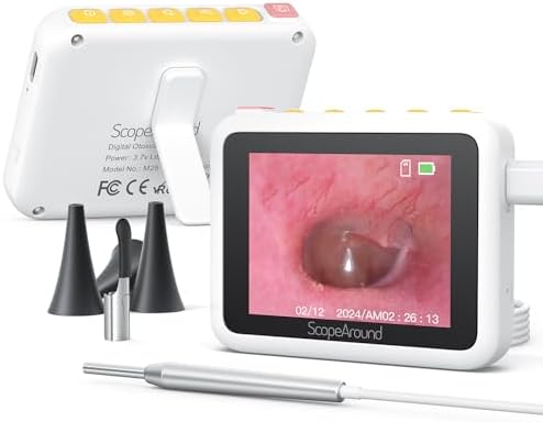 Amazon.com: Teslong Digital Otoscope, 1080p HD Ear Camera with Ear Wax ...