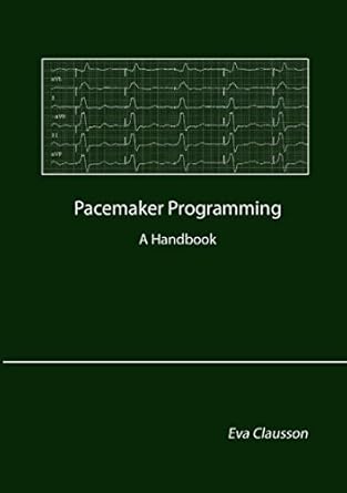 Pacemaker Programming: A Handbook eBook : Clausson, Eva: Amazon.co.uk ...