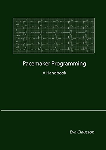 Pacemaker Programming: A Handbook eBook : Clausson, Eva: Amazon.co.uk ...