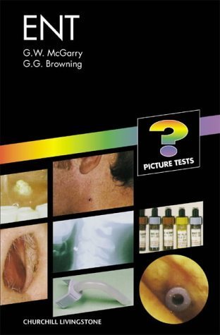 Colour Guide Picture Test: ENT (Colour Guides): 9780443062353: Medicine ...