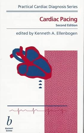 Cardiac Pacing: Kenneth A. Ellenbogen: 9780865424715: Amazon.com: Books