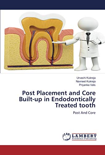 Post Placement and Core Built-up in Endodontically Treated tooth ...