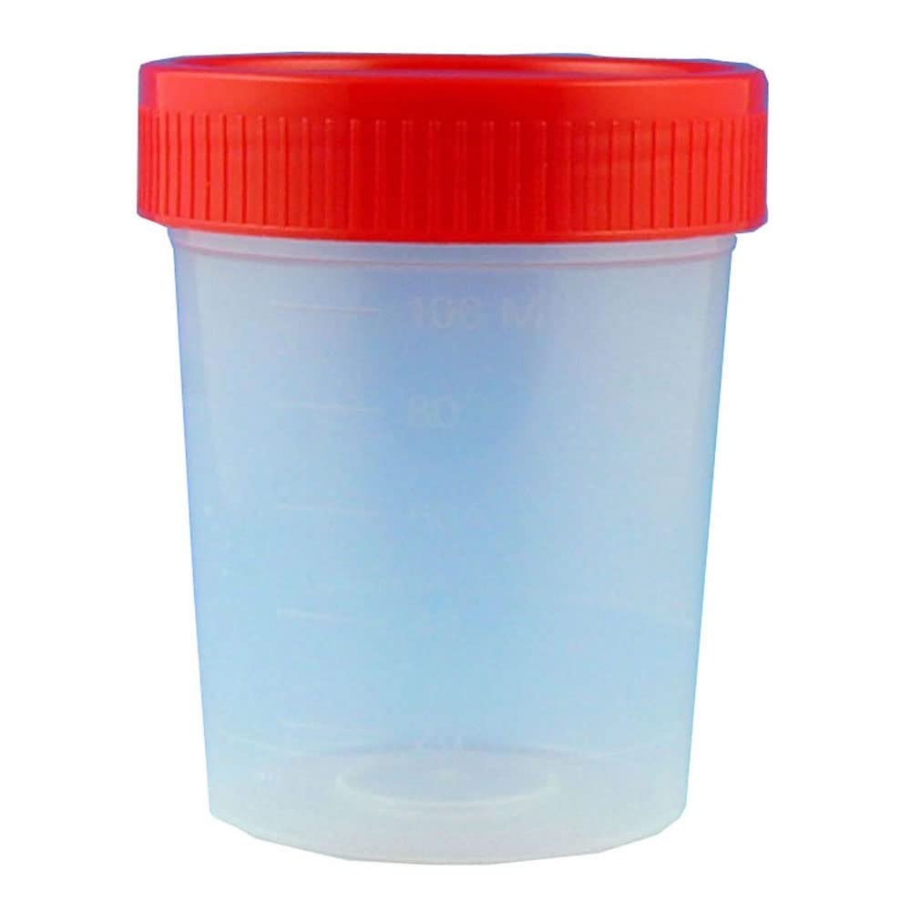 Amazon.com: Globe Scientific 5914 Polypropylene Specimen Graduated ...