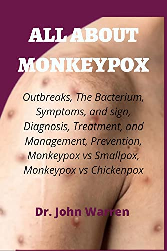 ALL ABOUT MONKEYPOX: Outbreaks, The Bacterium, Symptoms, and sign ...