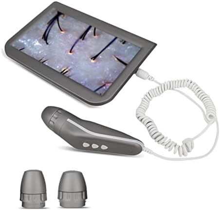 Amazon.com: Skin Diagnosis Hair Analyzer,10.1 Inch Charging Type Scalp ...