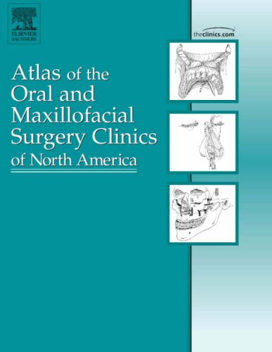 Mandibular Reconstruction, An Issue of Atlas of the Oral and ...