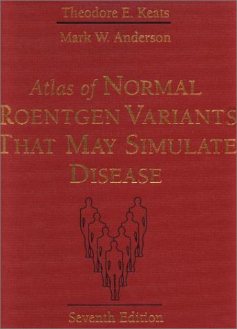 Atlas of Normal Roentgen Variants That May Simulate Disease ...
