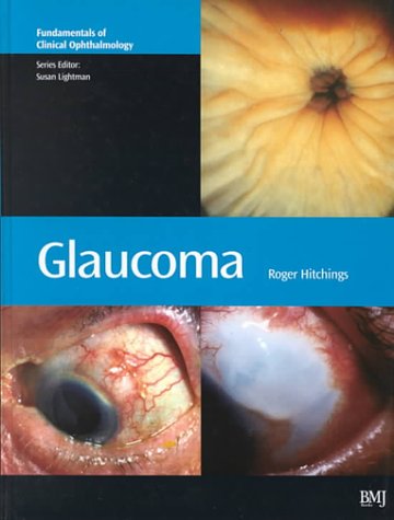 Glaucoma: Fundamentals Of Clinical Opthalmology: 9780727914484 ...