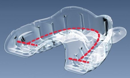 Amazon.com: DENPLANT Low Temp Tray Medium-Upper 12 Trays/JAR ...
