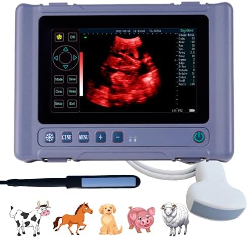 Amazon.com: RUISHENG T1 8-inch Touch Screen Portable B-Ultrasound ...
