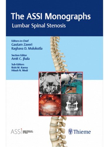 LUMBAR SPINAL STENOSIS: 9789386293510: Books - Amazon.ca
