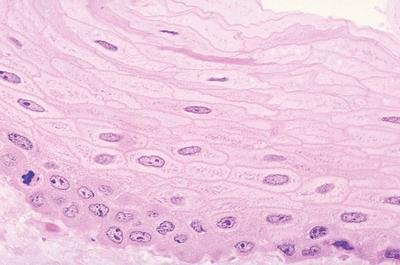 Stratified Columnar Epithelium Slide