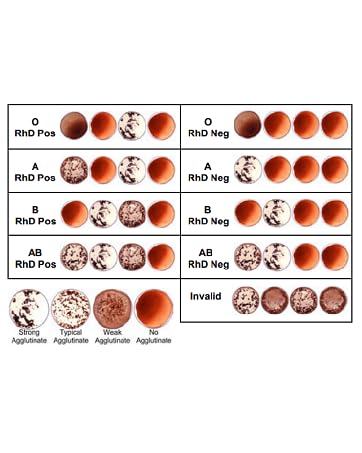 Snapklik.com : Eldoncard Blood Typing Kit, 2 Test Pack, Know Your Blood ...