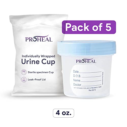 Snapklik.com : Sterile Urine Specimen Cups