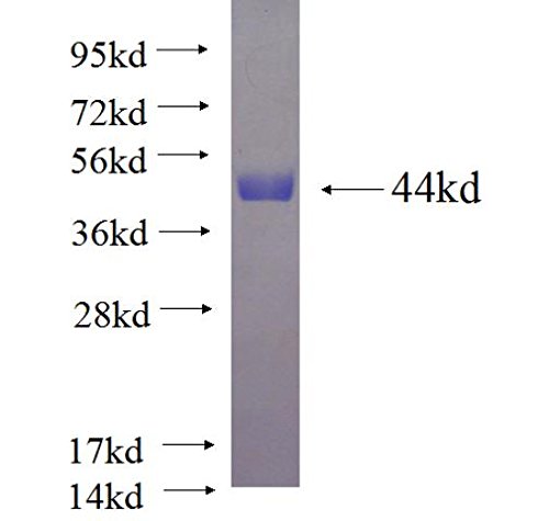 Amazon.com: Human SORD Fusion Protein : Industrial & Scientific