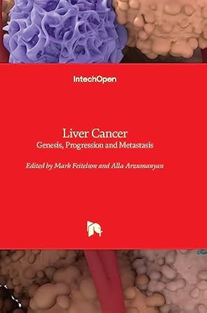 Liver Cancer - Genesis, Progression and Metastasis: Feitelson, Mark ...