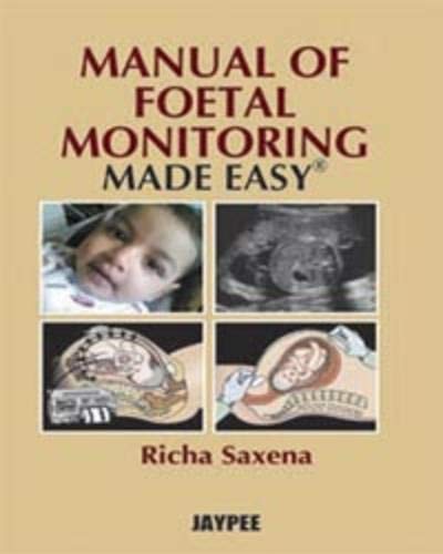 Manual of Fetal Monitoring Made Easy: 9788184485912: Medicine & Health ...