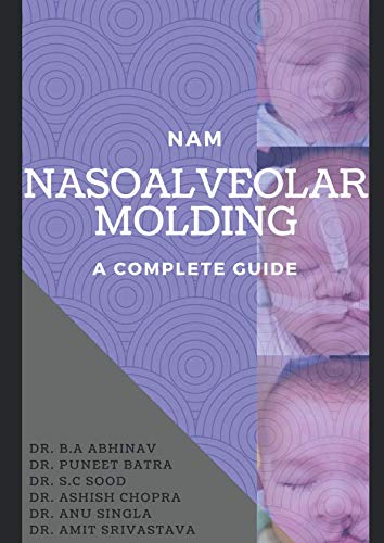 NAM- Nasoalveolar Molding: A Complete Guide For All The Information On ...