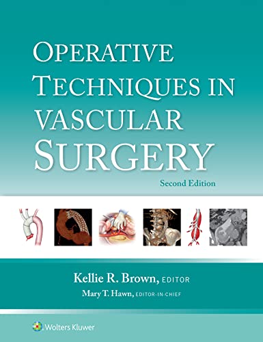 Amazon | Operative Techniques in Vascular Surgery (English Edition ...