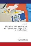 【発売日：2021年05月14日】・ブランド:LAP Lambert Academic Publishing・製造元:LAP LAMBERT Academic Publishing