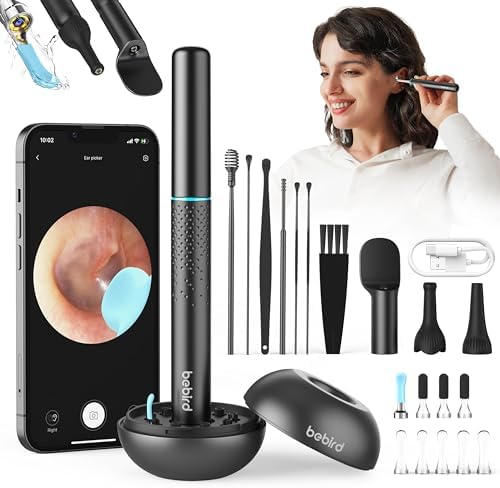 Amazon.com: ScopeAround Otoscope with Light, 3.9mm Ultra-Thin HD Smart ...