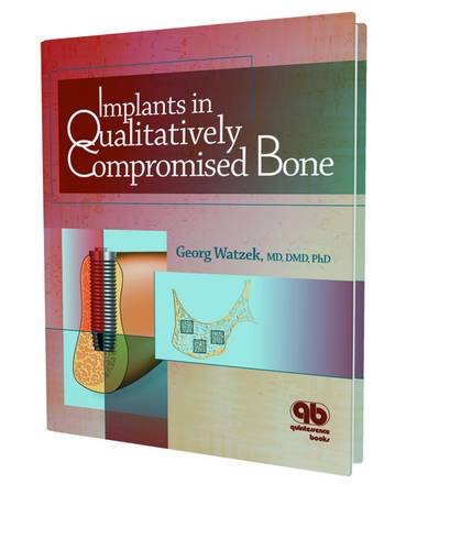 Implants In Qualitatively Compromised Bone: 9781850970507: Medicine ...