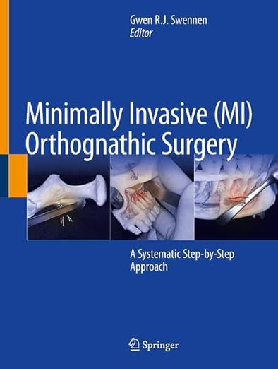 Minimally Invasive (MI) Orthognathic Surgery: A Systematic Step-by-Step ...