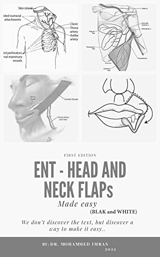 ENT - HEAD and NECK FLAPs MADE EASY (BLACK and WHITE): otolaryngology ...