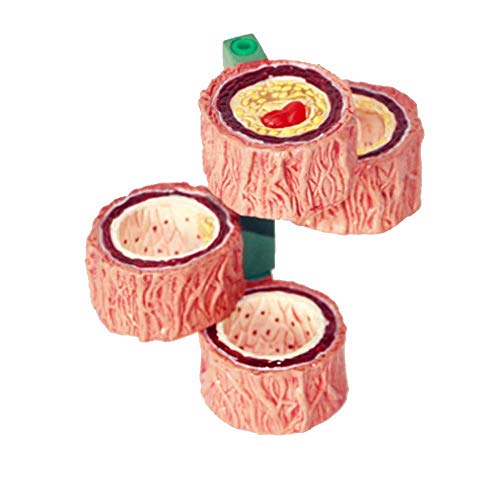 Buy Educational Model Anatomy Human Blood Vessel Atherosclerosis Model ...