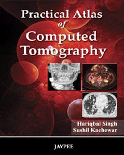 Practical Atlas of Computed Tomography: 9789380704920: Medicine ...