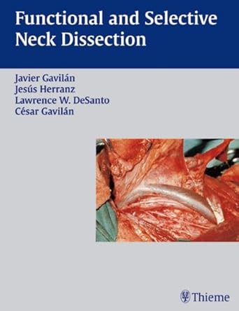 Functional and Selective Neck Dissection: 9781588900166: Medicine ...