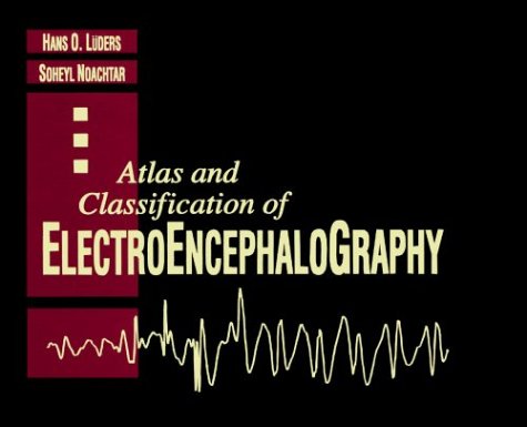 Atlas and Classification of Electroencephalography: 9780721665542: Medicine & Health Science ...