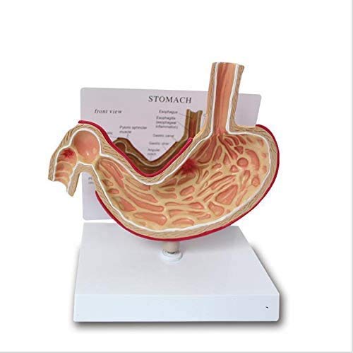 Model Of Human Stomach Model Of Gastritis Model Of Gastric | Desertcart ...