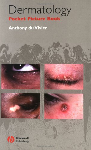Dermatology Pocket Picture Book: 9780632054282: Medicine & Health ...