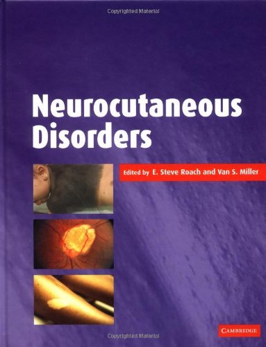 Amazon.com: Neurocutaneous Disorders eBook : Roach, E. Steve, Miller ...